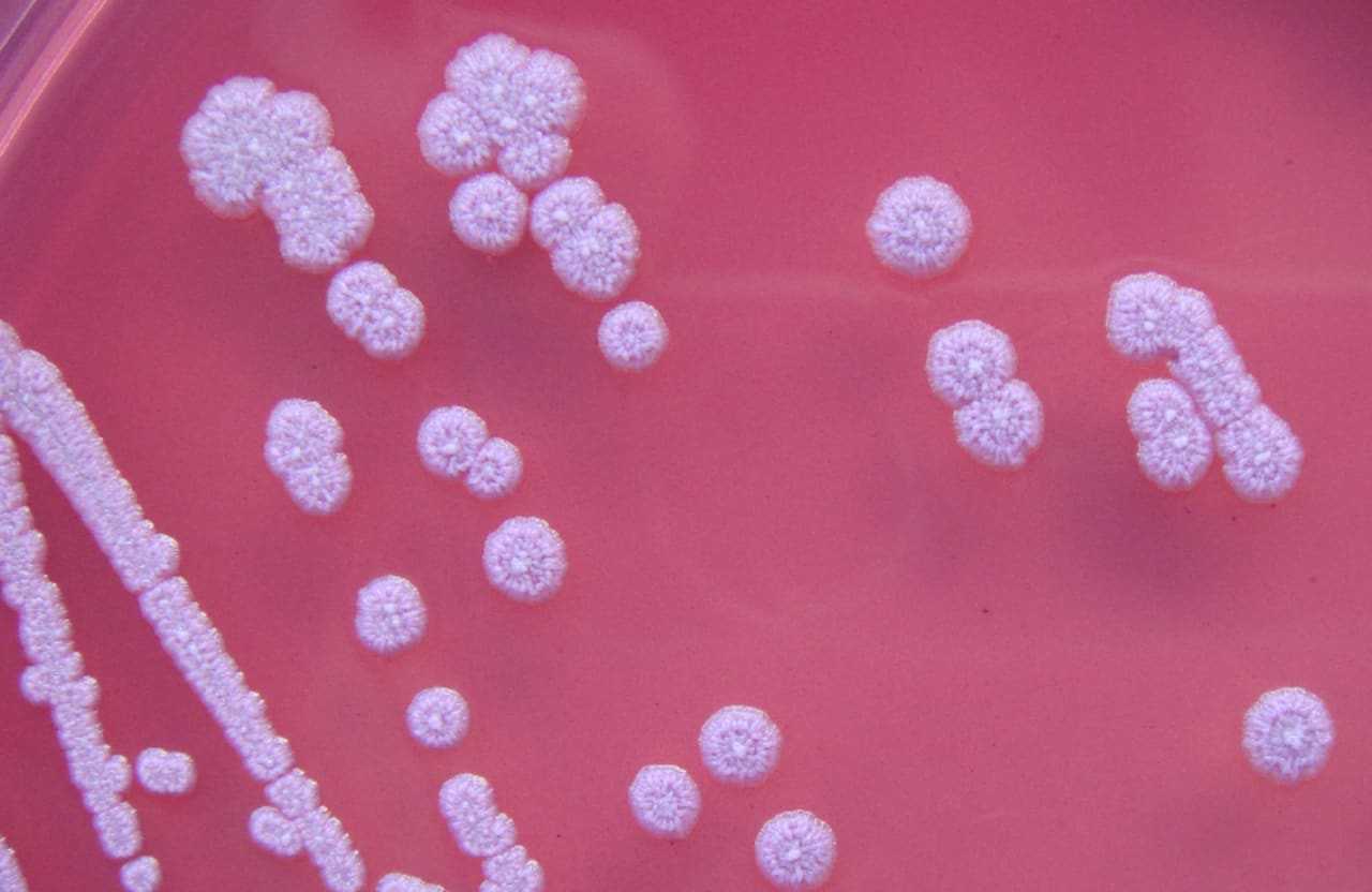 Potentially Fatal Bacteria Prompts CDC Warning | Newburgh Daily Voice Potentially Fatal Bacteria Prompts CDC Warning | Newburgh Daily Voice