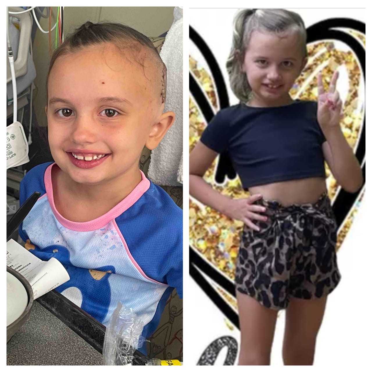 Support Surges For 6 Year Old Nj Girl Battling Brain Cancer Ocean Daily Voice