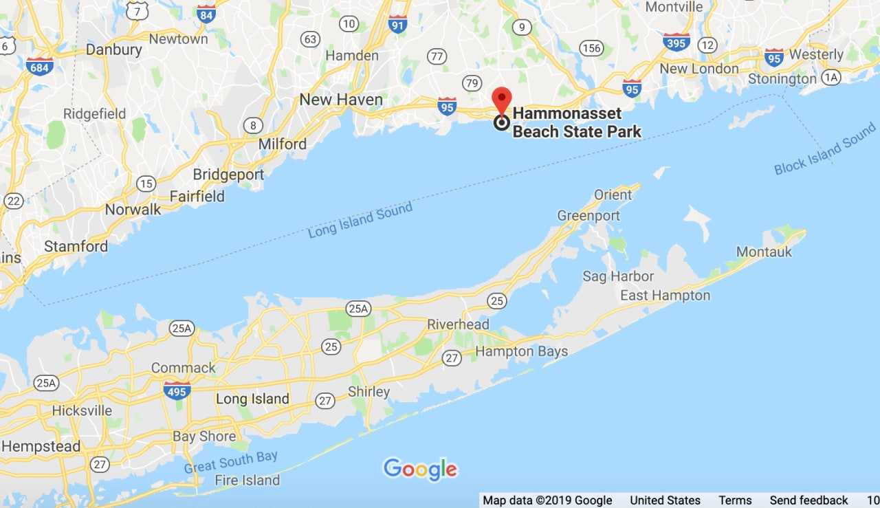 Ct Man Has Leg Amputated After Contracting Flesh Eating Bacteria