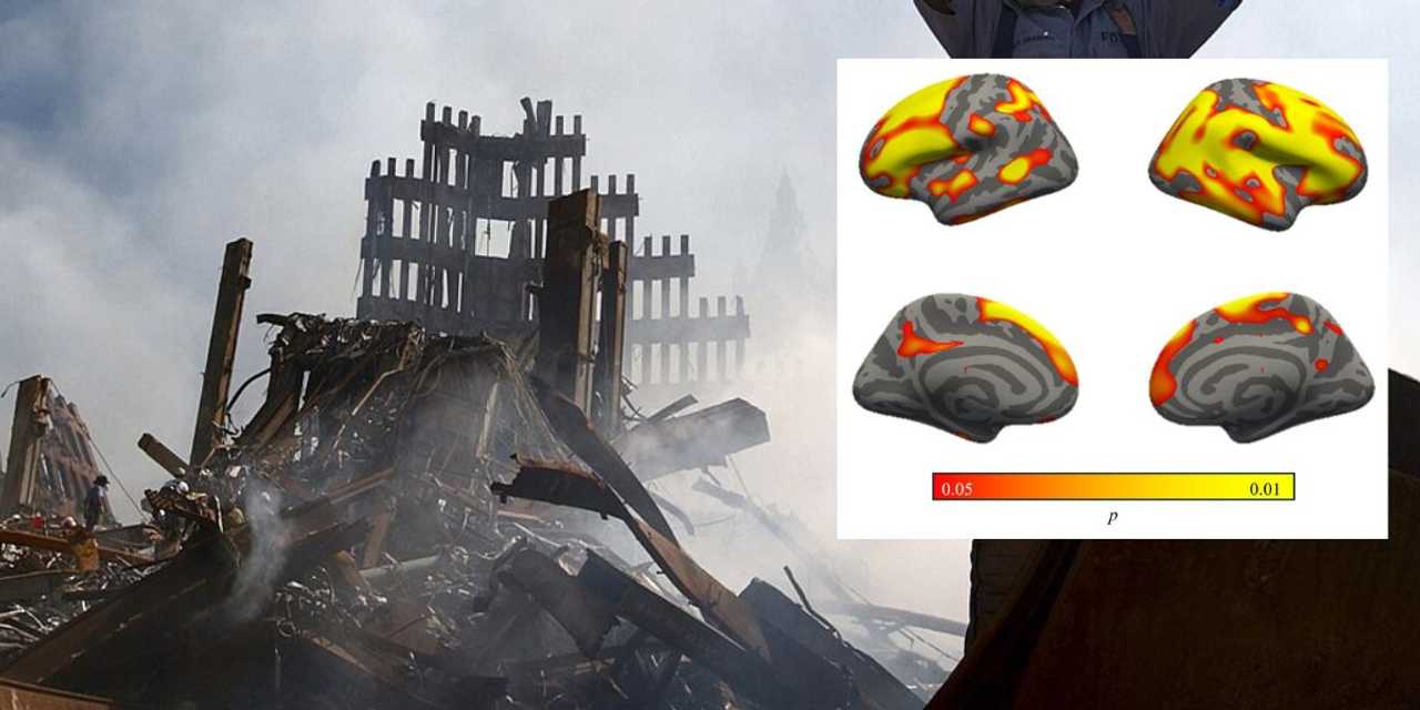9/11 Trauma Physically Altered Responders’ Brains, Study Finds ...