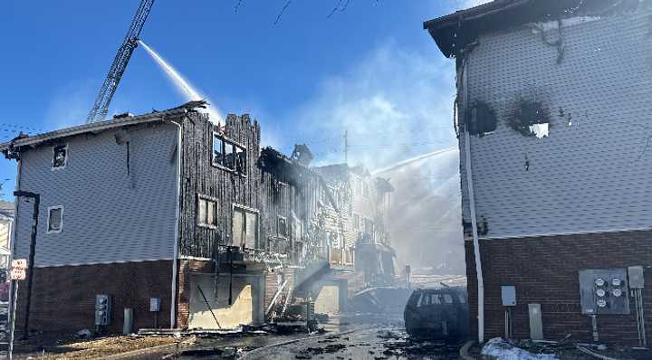 Fire Rips Through Leonia Condos (Developing) | Bergenfield Daily Voice