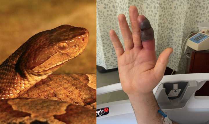 Cyclist Bitten By Venomous Snake On NJ Bike Path After Getting Too ...