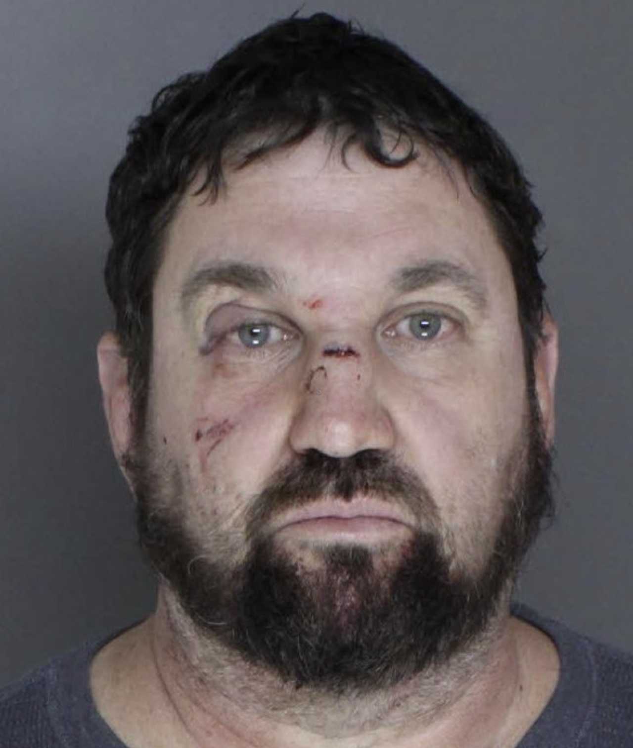 Carlisle Driver Drunk At Highest Rate Slams Into Truck Parked In ...