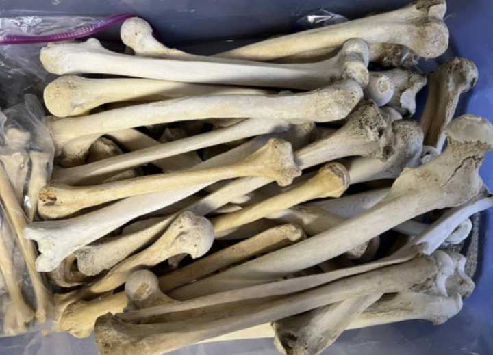 Stillborns, Harvard Cadaver Parts Sold Nationwide By PA Man Sentenced ...