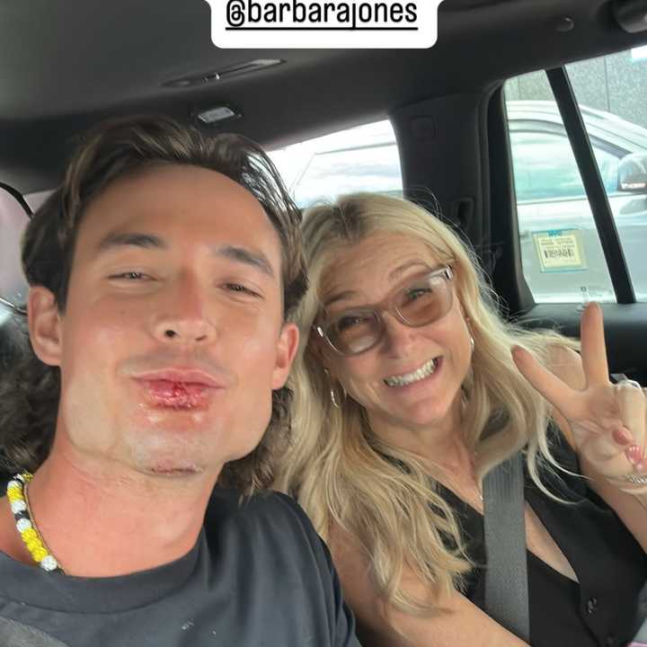 Watch: Savannah Bananas Star Face-Plant Mid-Flip On Live TV | Newark ...