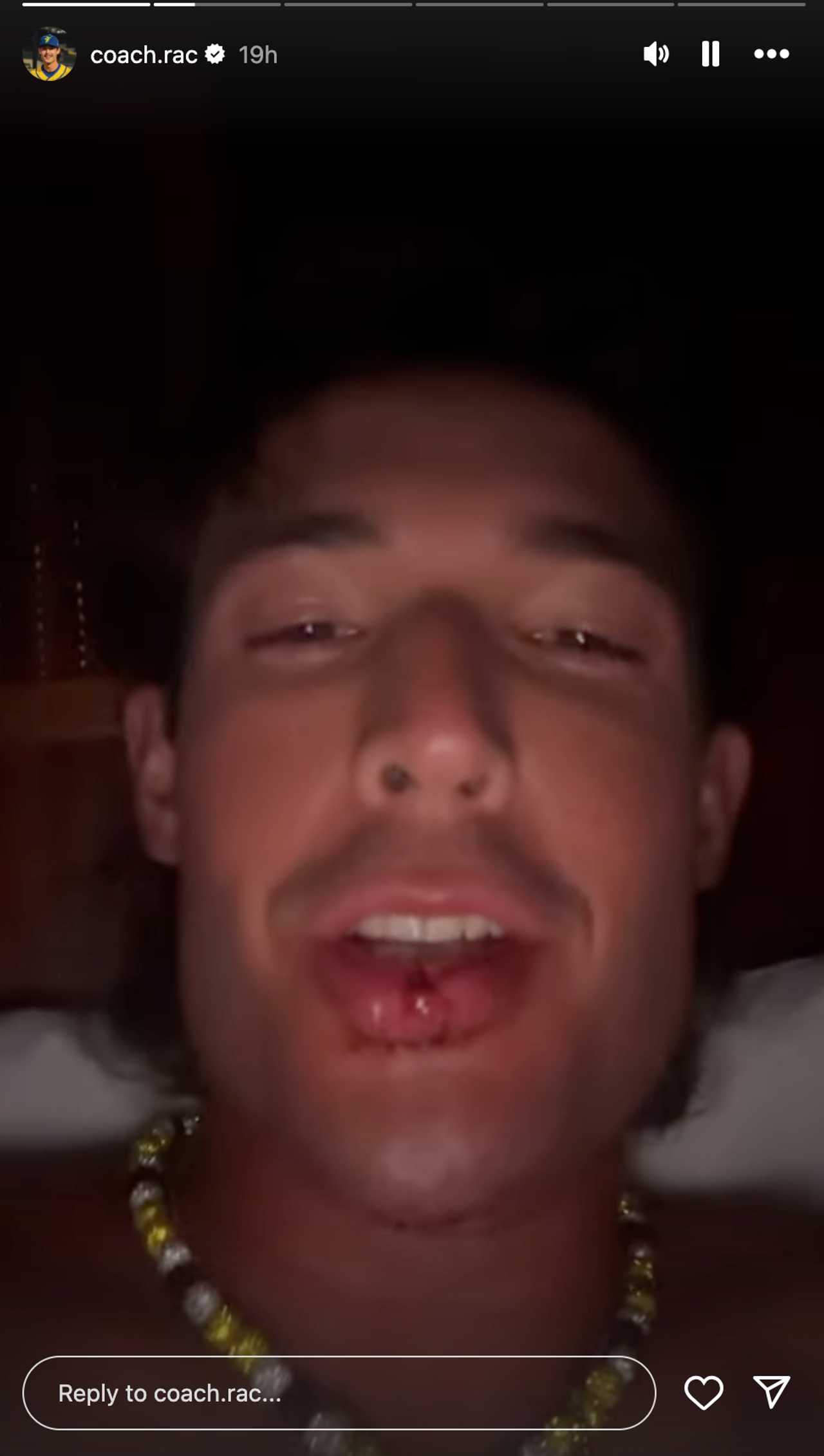 Watch: Savannah Bananas Star Face-Plant Mid-Flip On Live TV | Mays ...