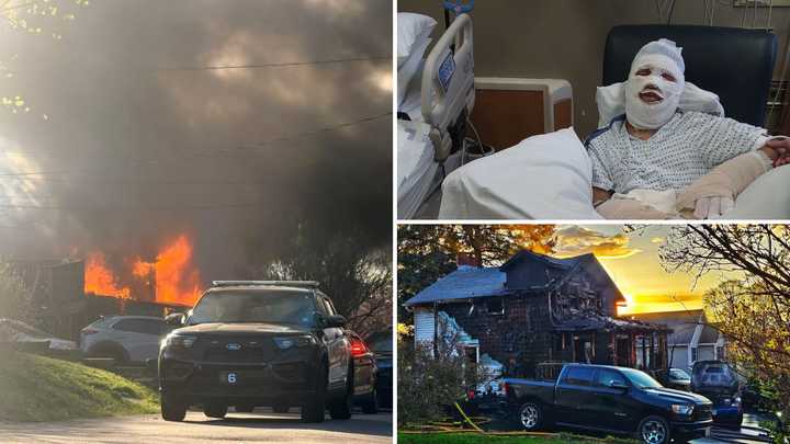 Support Comes To Family Hurt In Fatal House Fire In Beacon: Boy, 15 ...