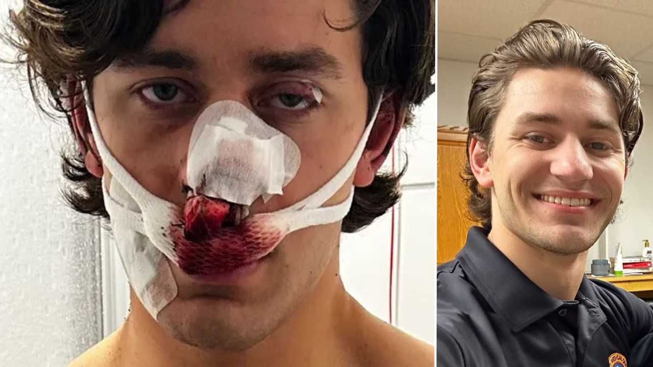 Heroic NY Paramedic, Model Stabbed While Saving Women From Attackers In ...